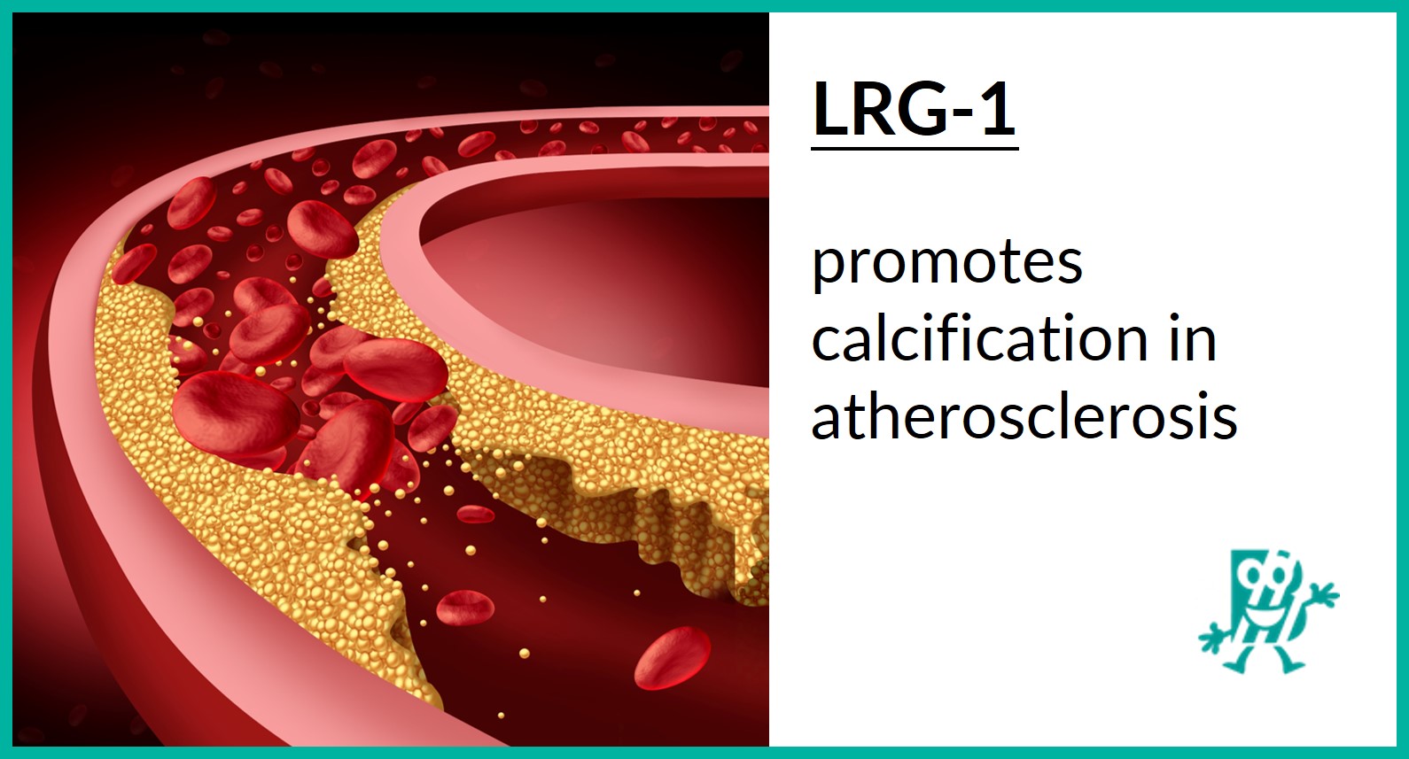 LRG-1 promotes calcification in atherosclerosis | Biomedica